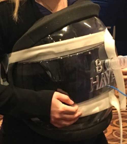Biphasic Cuirass Ventilation
